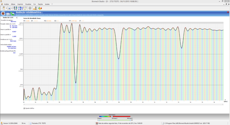 O que é o parâmetro Sway do COP? Como e quando atentar-se a ele? - Kinetec